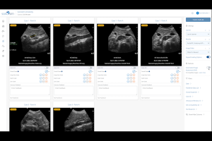 SonoSim Launches Automated Ultrasound Image Assessment powered by ...