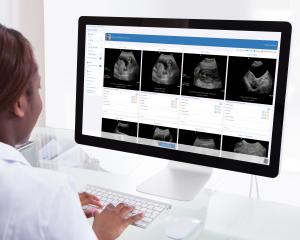 SonoSim Launches Automated Ultrasound Image Assessment powered by ...