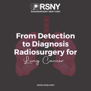Dr. Gil Lederman and RSNY Revolutionize Cancer Treatment with ...