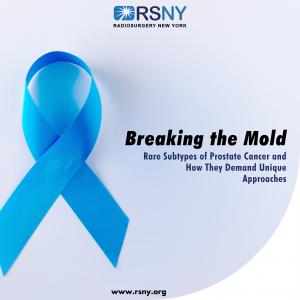 Cancer in Prostate: Types of Prostate Cancer: Understanding the Differences