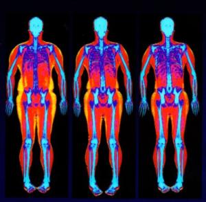 DexaCan, A DXA Scan Clinic Offering Advanced Body Composition ...