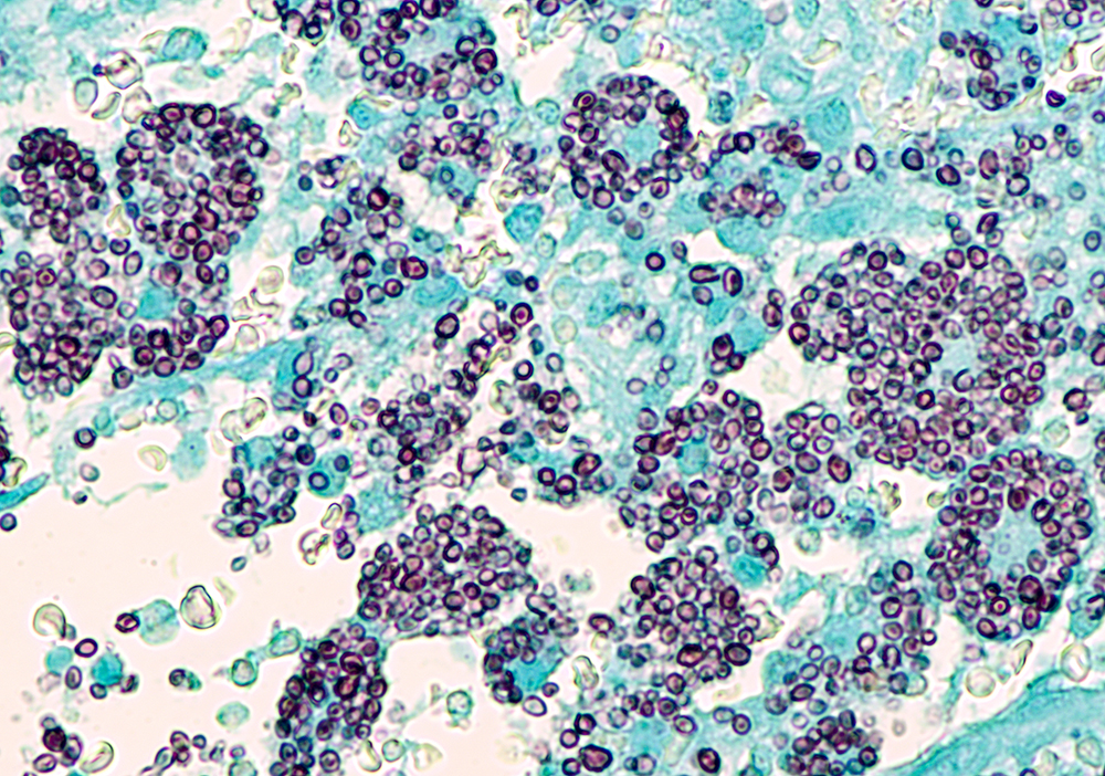 Histoplasma Capsulatum Dimorphic Fungal Pathogens | Mycology
