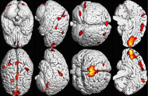 Sworn Testimony and Official Documents Confirm Fluoride’s Health Risk ...
