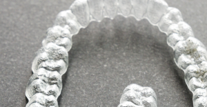 FirstClass Aligners Unveils New Reasons Why Clear Aligners Offer a Modern Alternative to ...