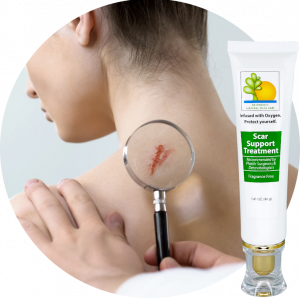 Proper care of a scar is critical to its healing process - Scar Support ...