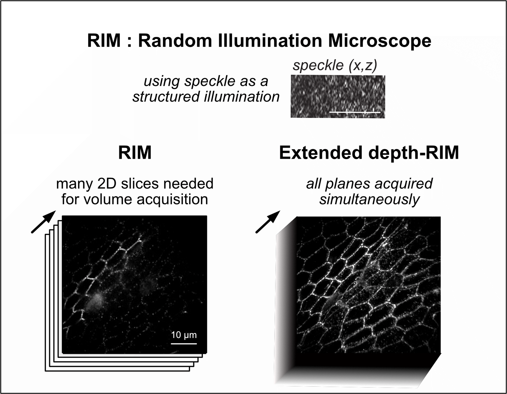 Fast Super Resolved Microscopy With A Structured Illumination And Extended Depth Detection