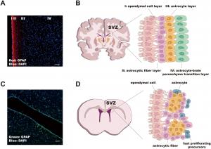 The Subventricular Zone: A Key to Unlocking Neurological Treatments ...