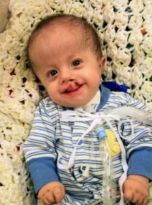 American Academy of Pediatrics Historic Guidance on Trisomy 13 and ...