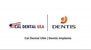 Cal Dental USA and Dentis Implants Strike a Deal to Deliver Quality ...